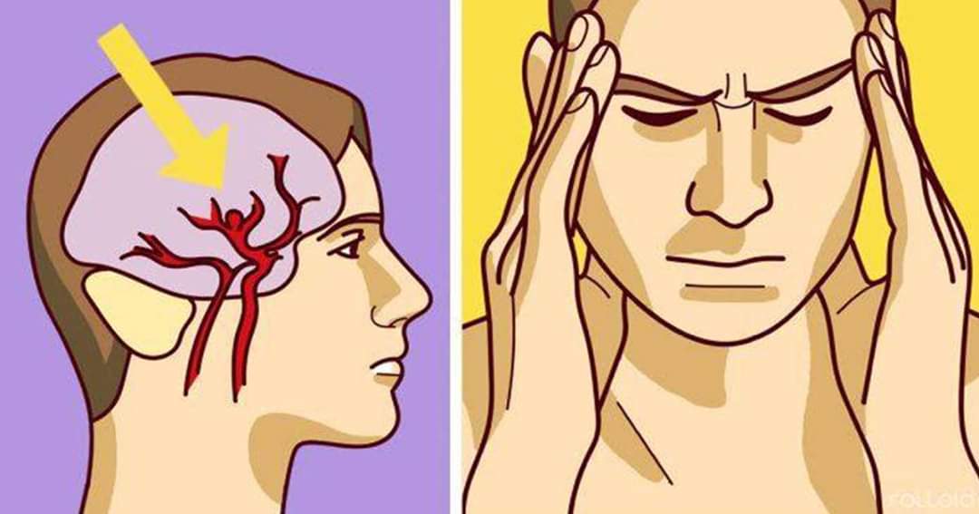Causas, síntomas y tratamiento para controlar una hemorragia cerebral ...